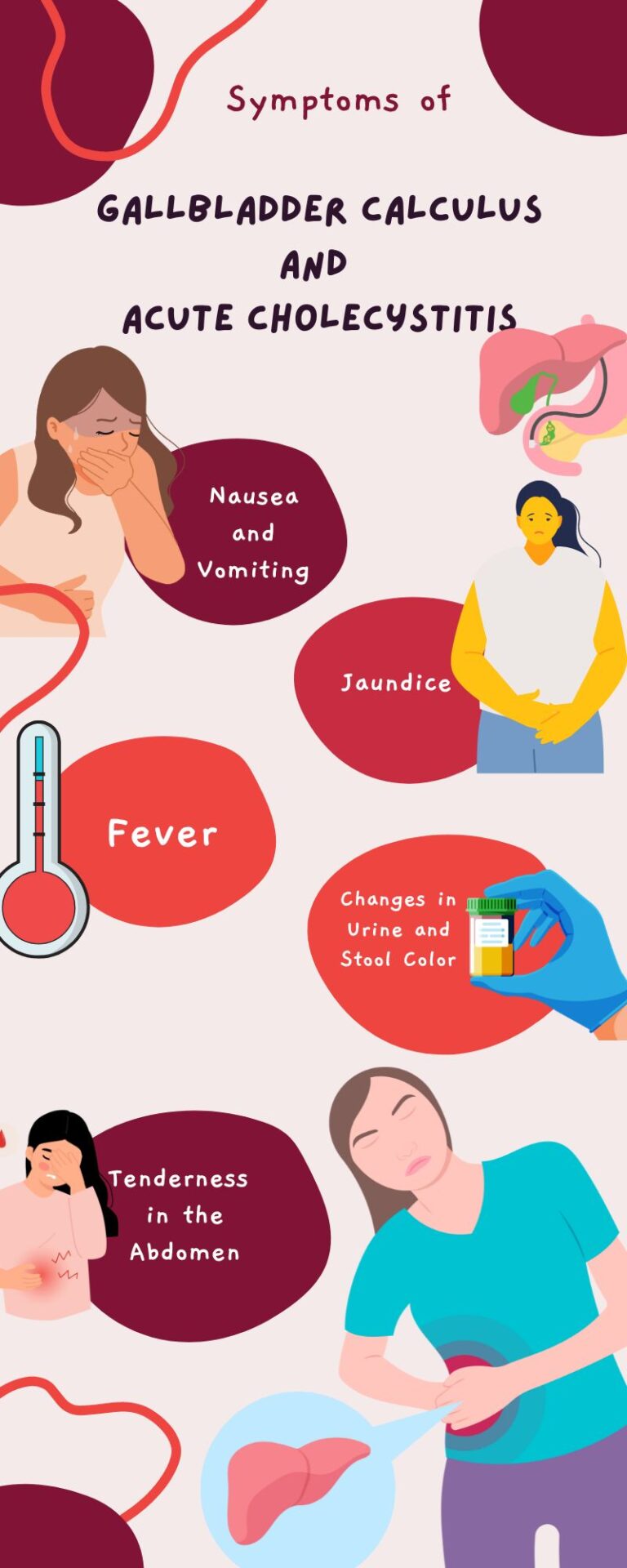 Gallbladder Calculus and Acute Cholecystitis - Symptoms and Treatment ...