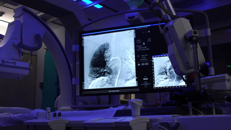 How to Treat a Blood Clot in Your Leg - DVT Treatment Options - Iaas Med