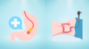 Choosing Between a Lower Endoscopy vs Colonoscopy